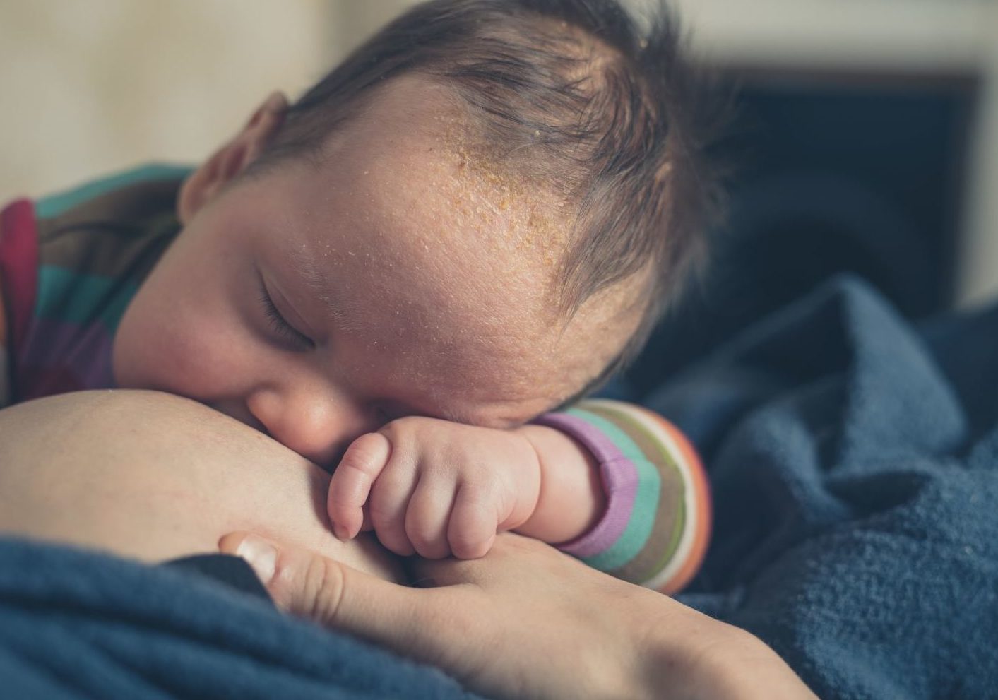 Ciemieniucha - jak wygląda, dlaczego się pojawia i jak ją leczyć?